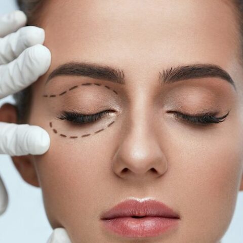 Shave Excision Mole Removal | Cosmedics Skin Clinics